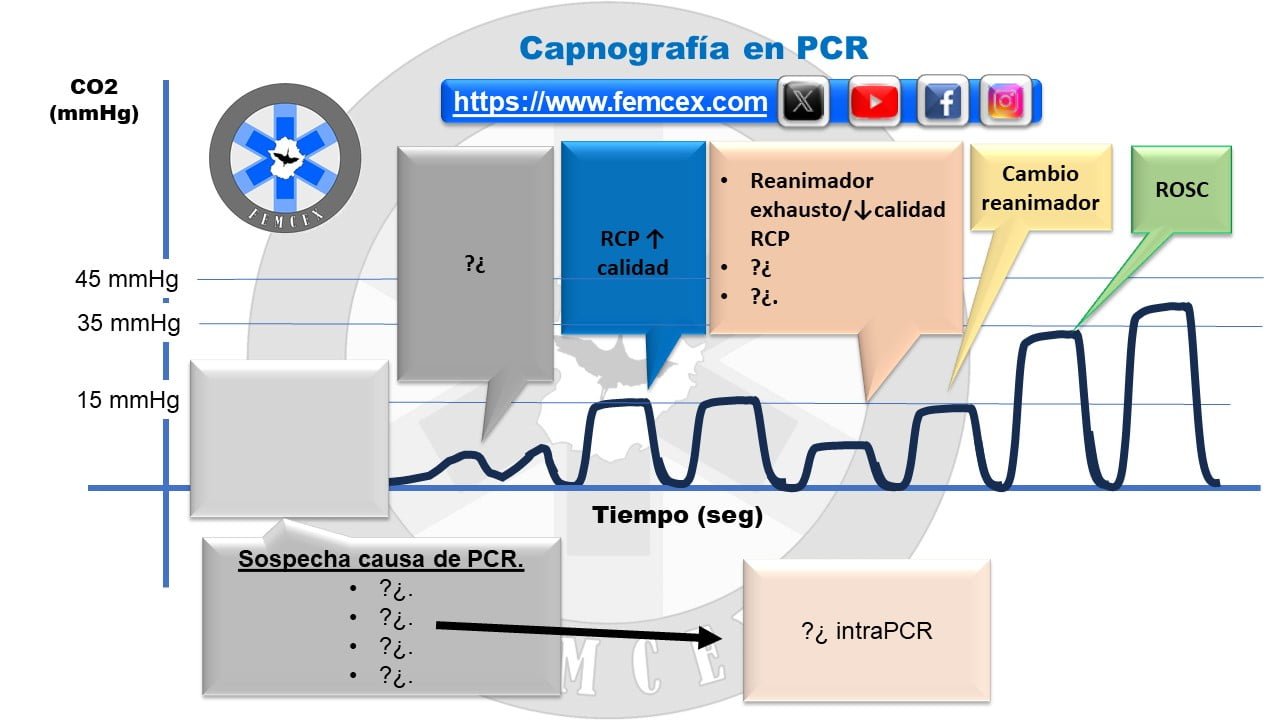 "Mis primeros pasos..." ya ando en la práctica de la capnografía ...